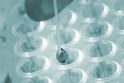 Assay Development – InBios International, Inc.